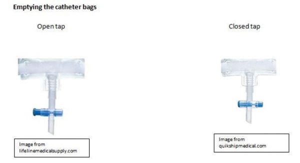 Catheter Care at Home – GM Urology